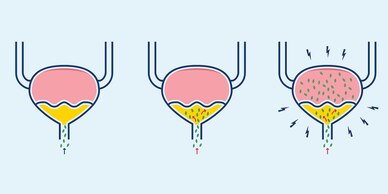 Frequent urination in pregnancy: Causes and tips | TENA Women